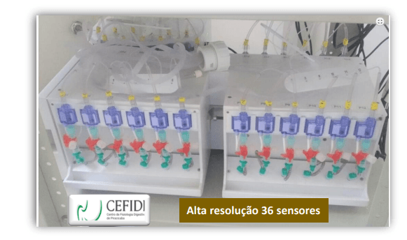 Manometria do esôfago de alta resolução – CEFIDI
