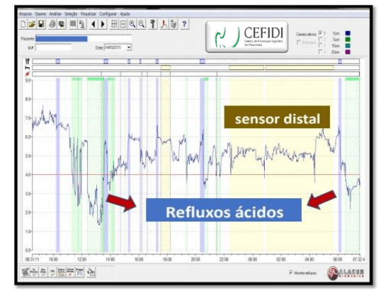Phmetria Esofágica Computadorizada 24hs – CEFIDI